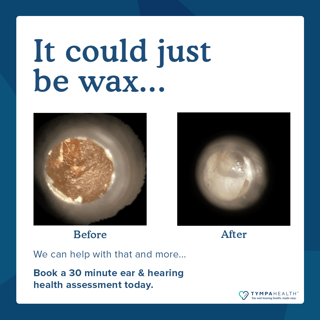 Microsuction Wax Removal | Vitaltone Pharmacy